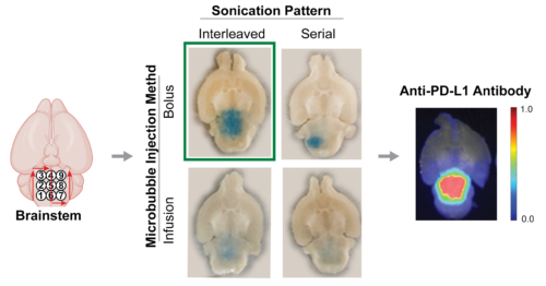 Successfully Opening a Larger Volume of the Blood-Brain Barrier - Focused Ultrasound Foundation