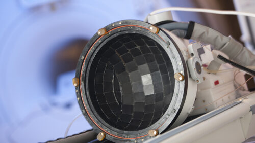 Insightec Granted Permanent Reimbursement Code for Brain Treatments ...