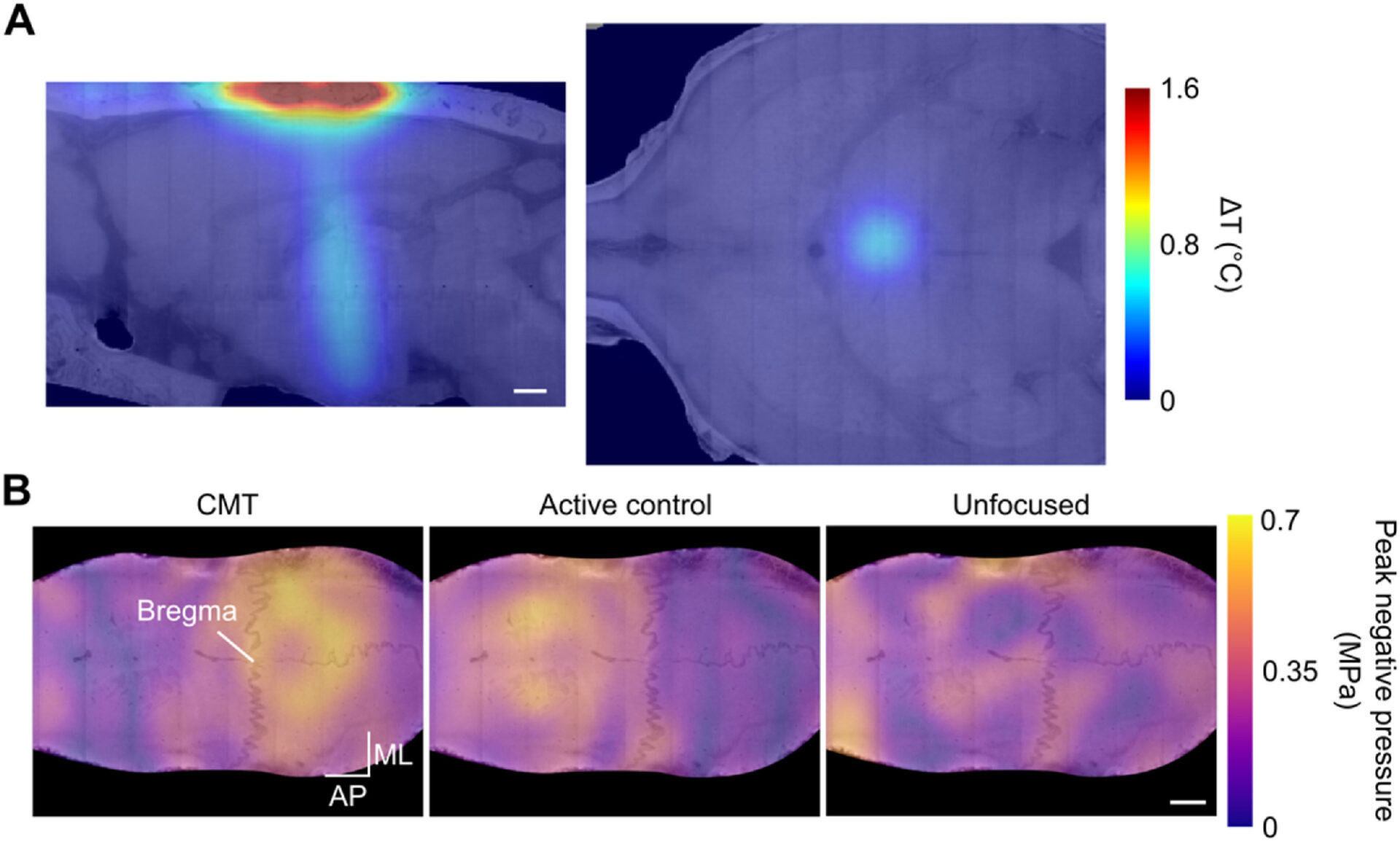 A New Focused Ultrasound Neuromodulation System For Preclinical Brain Research Focused