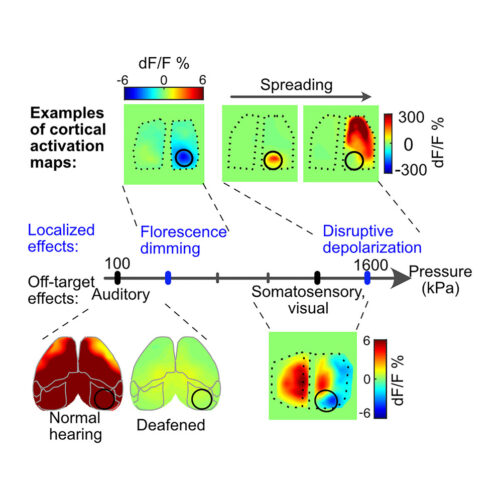 Caltech Team Develops New Preclinical Model for Focused Ultrasound ...