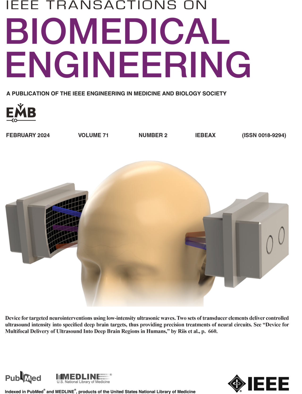 SPIRE Deploys Effective, Safe Ultrasonic Neuromodulation Device ...