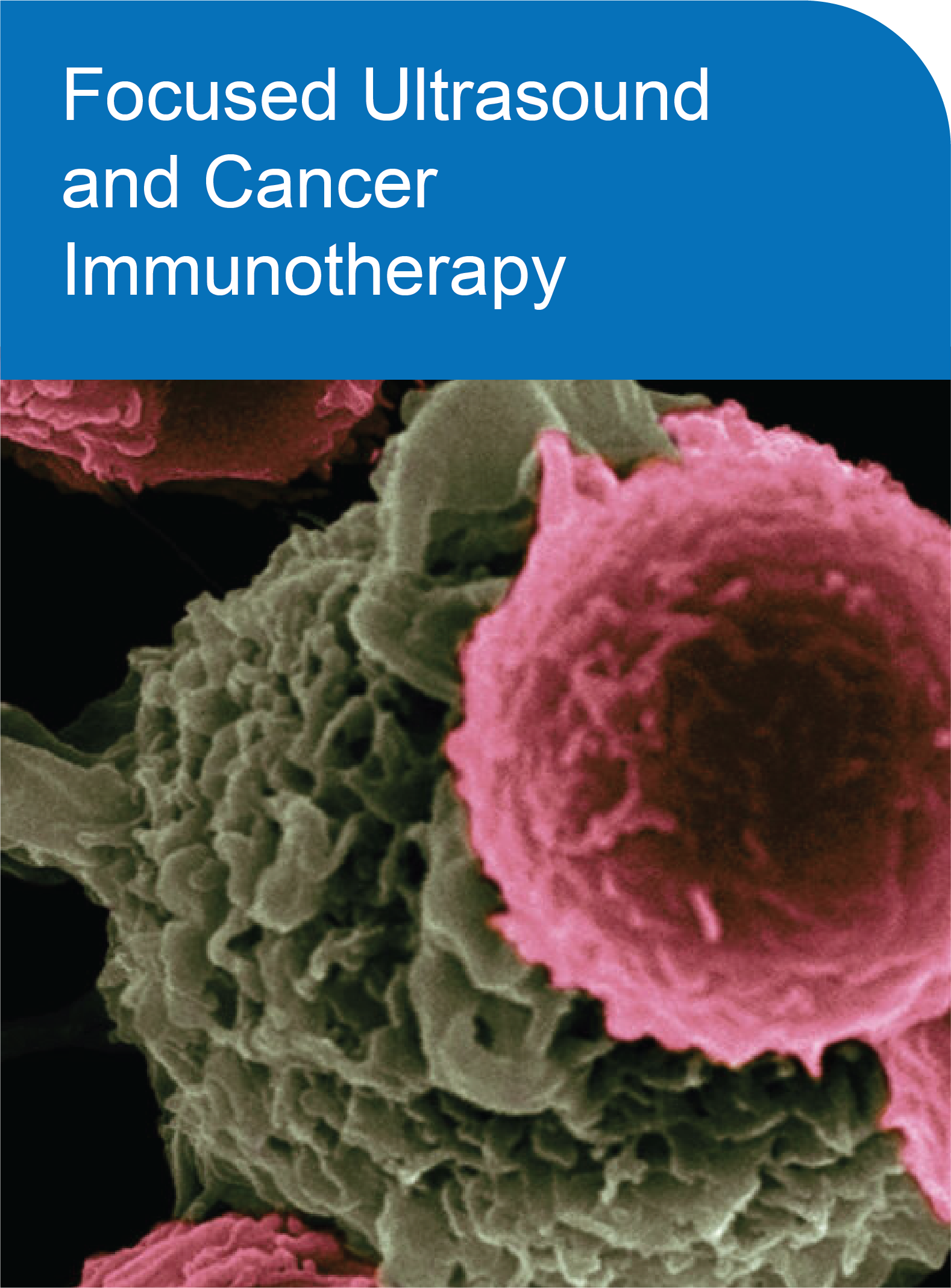 The Foundation - Focused Ultrasound Foundation