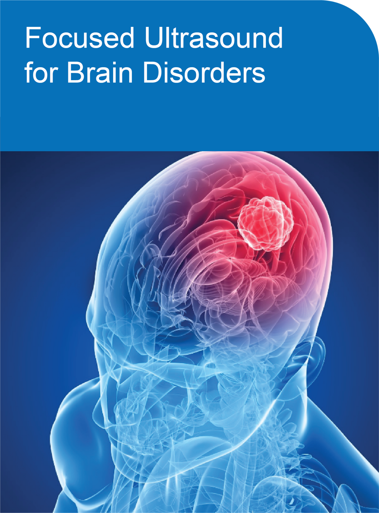 The Foundation - Focused Ultrasound Foundation